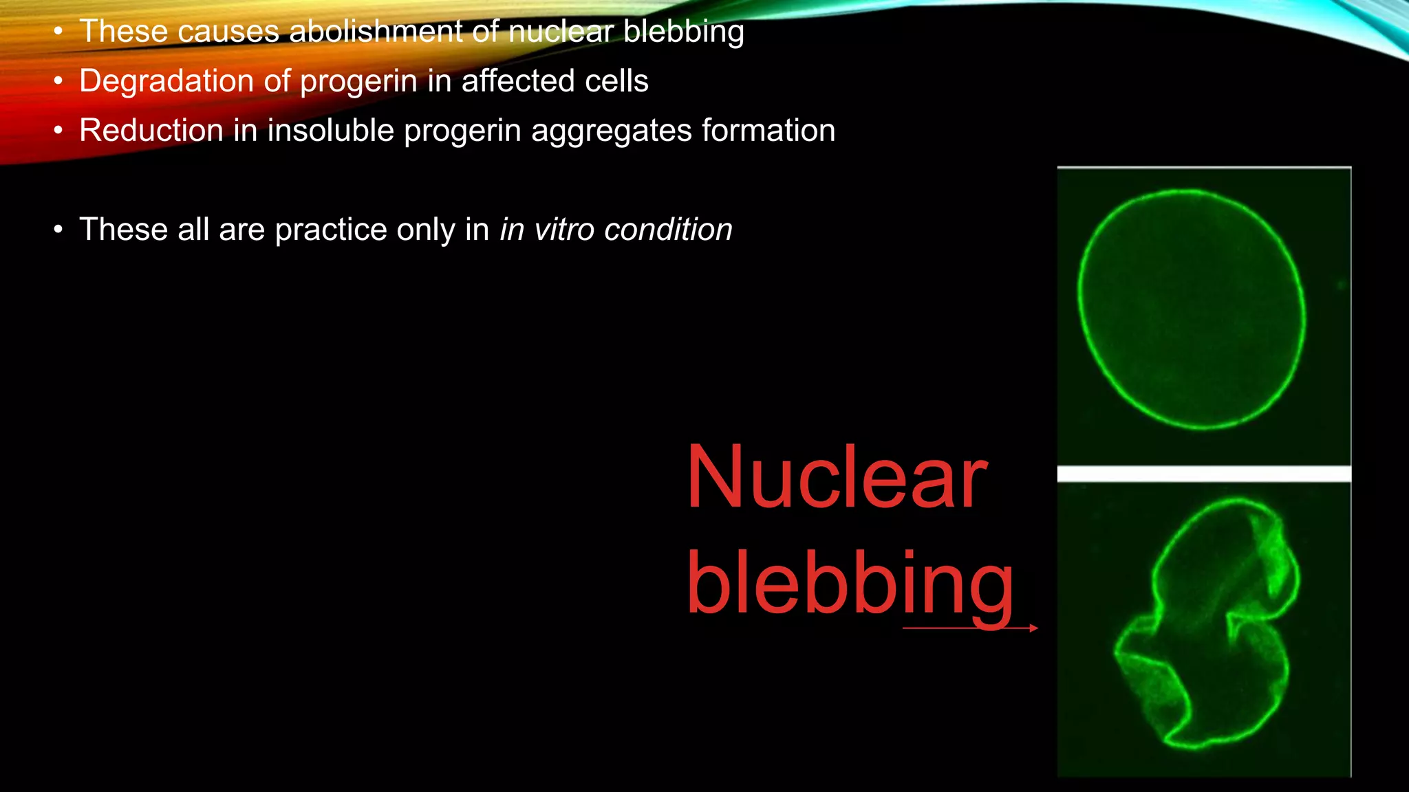 Progeria syndrome | PPTX