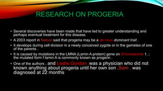 Progeria syndrome | PPTX