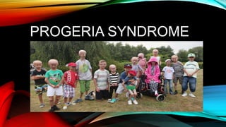 Progeria syndrome | PPTX