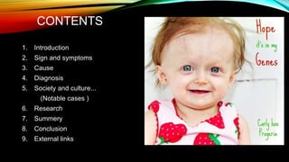 Progeria syndrome | PPTX