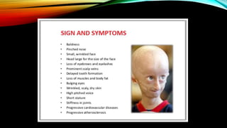 Progeria syndrome | PPTX