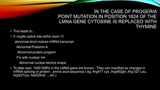 Progeria syndrome | PPTX