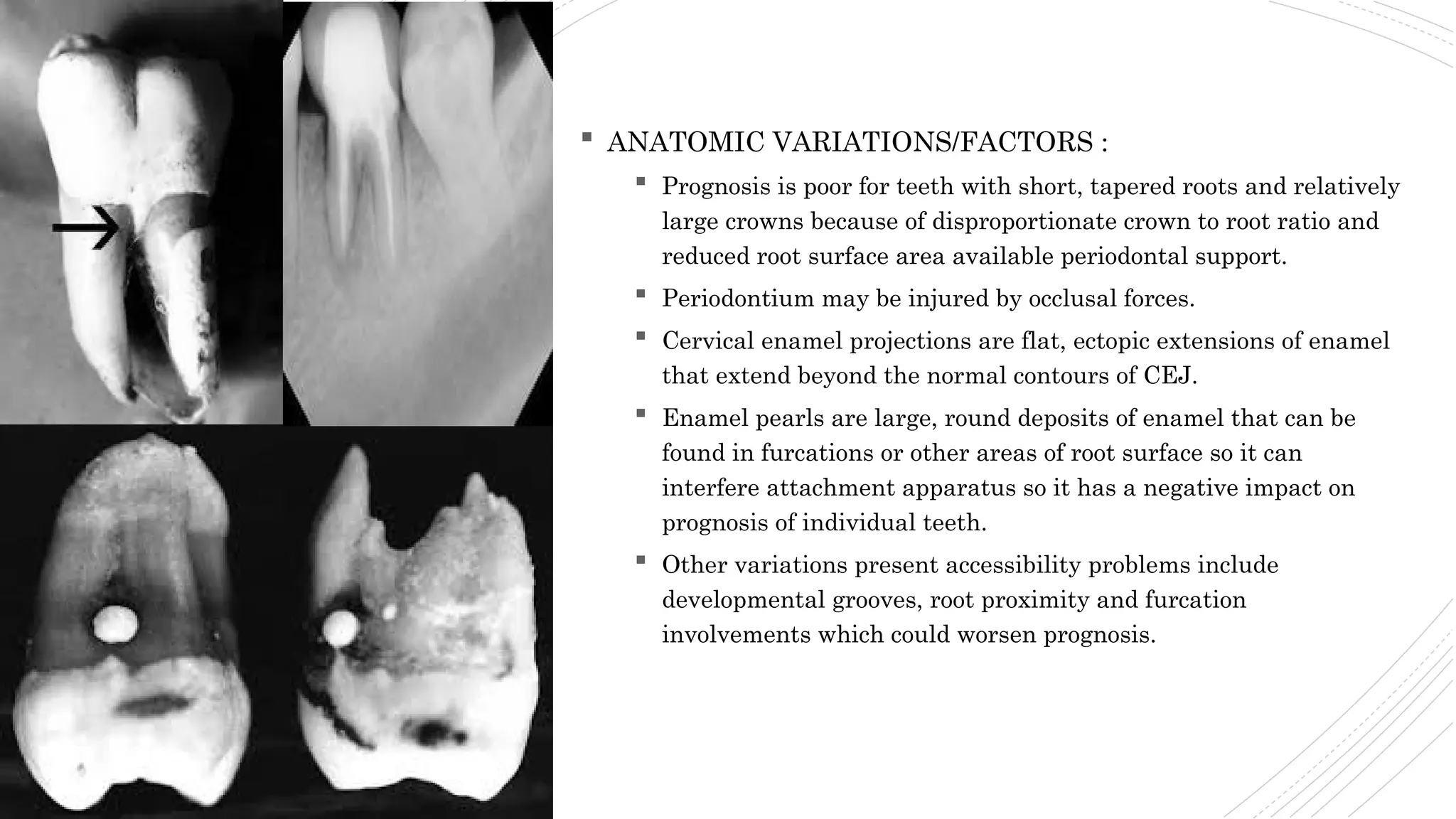 PROGNOSIS in periodontium in periodontics | PPTX