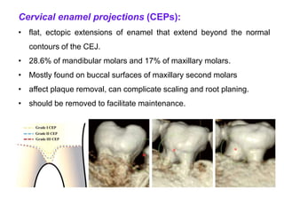 Cervical Enamel Projection