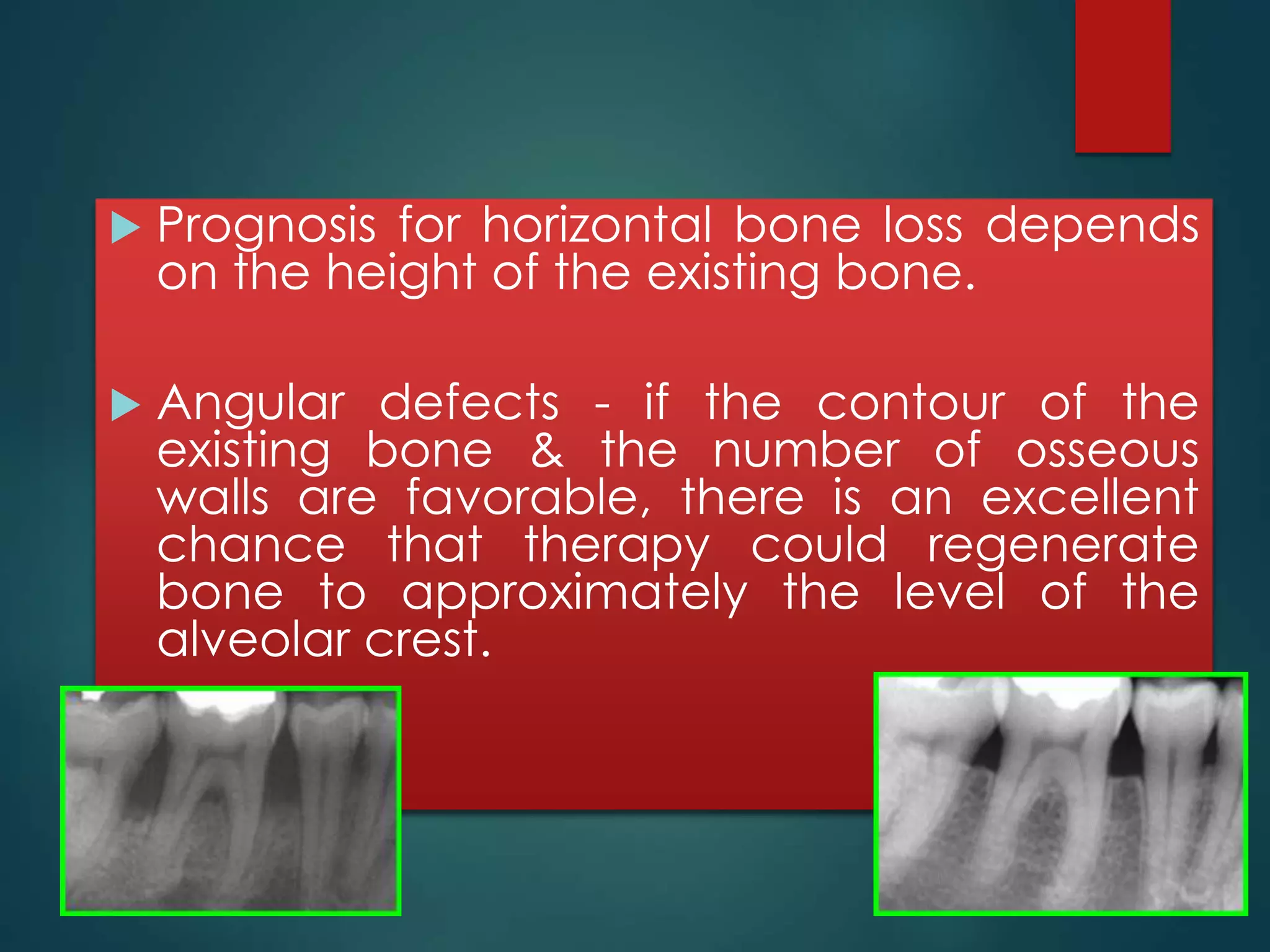 Prognosis in periodontics | PPTX