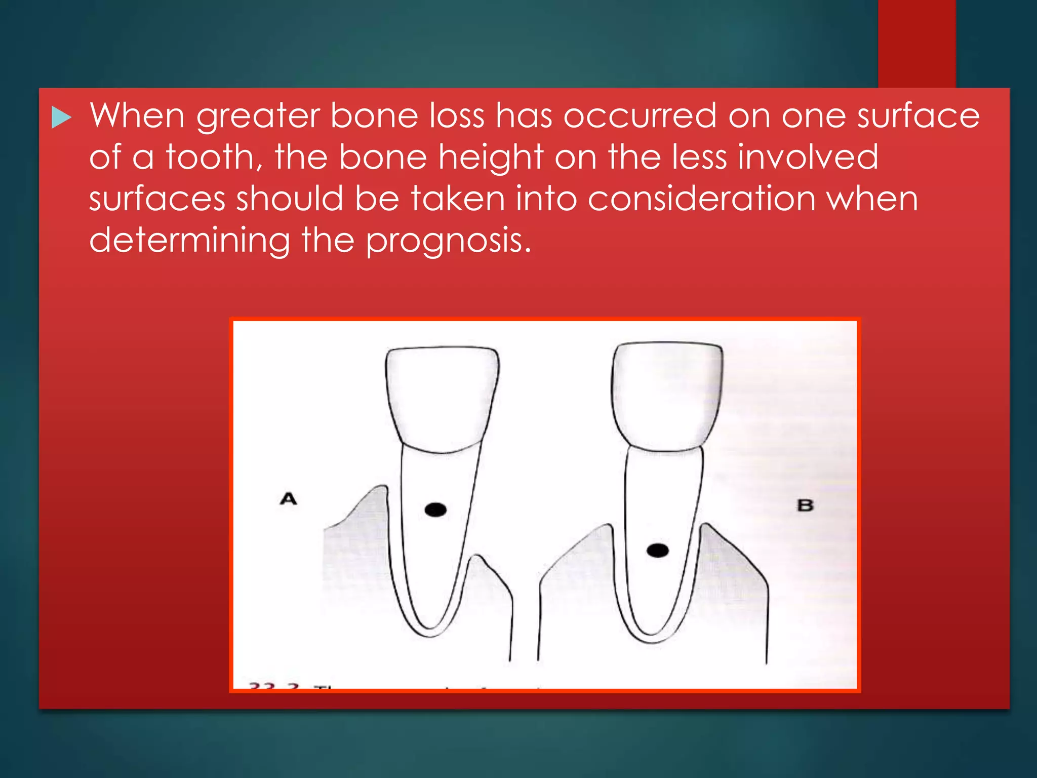 Prognosis in periodontics | PPTX