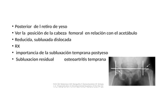 Prognostication in Developmental Dysplasia of the Hip Using.pptx