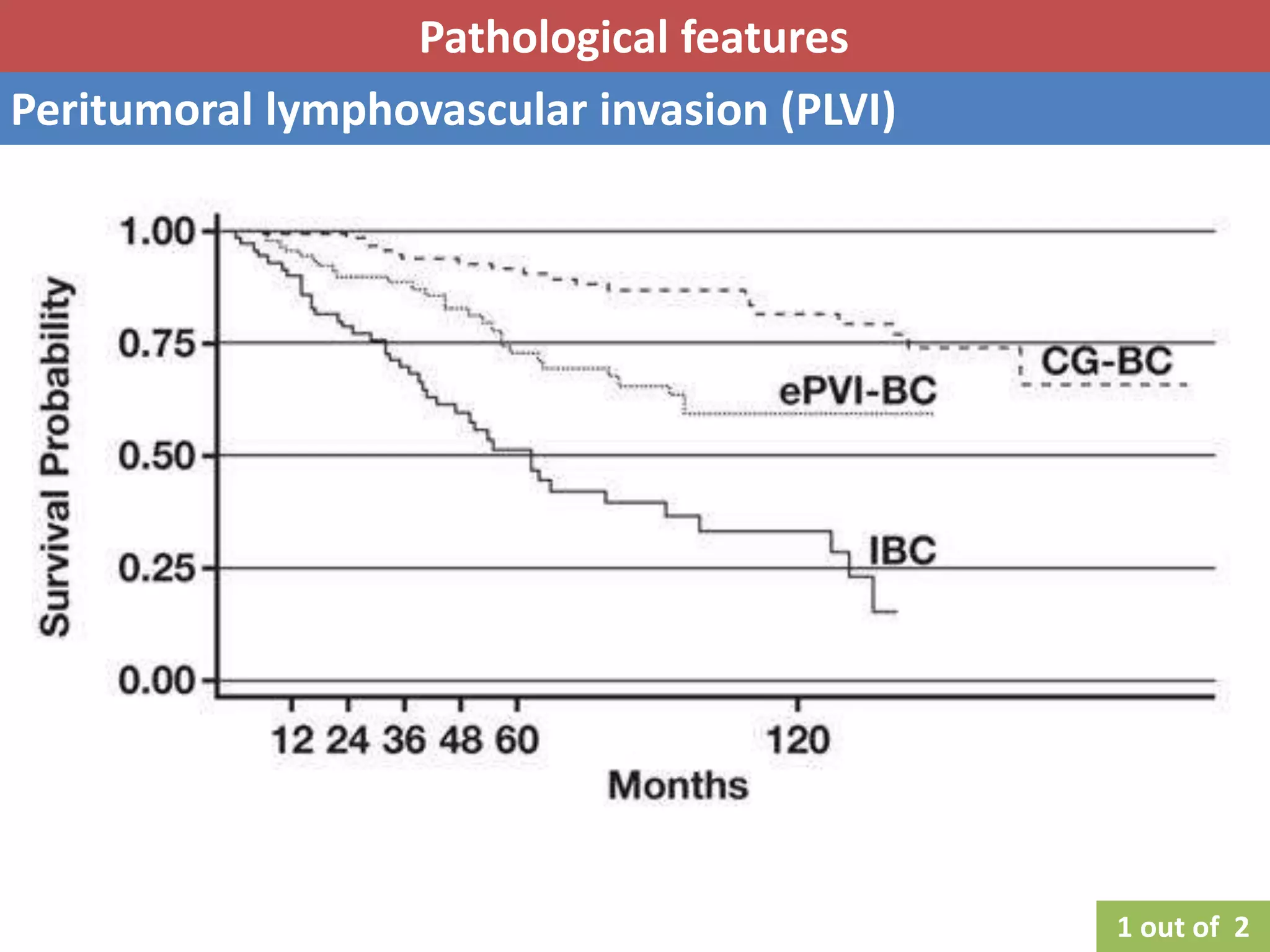 Prognostic & predictive factors of breast cancer | PPTX