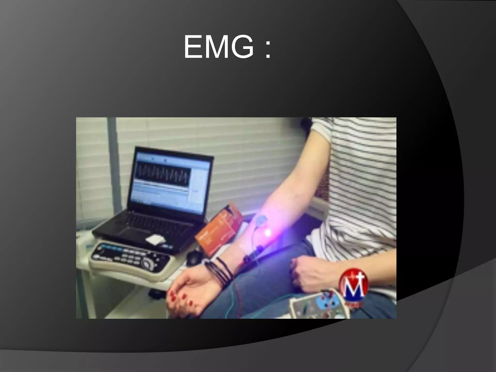 Prognostic test in facial nerve palsy in( ENT ) | PPTX