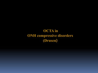Prognostic value of multiple differential diagnosis of ONH by OCT Angio ...