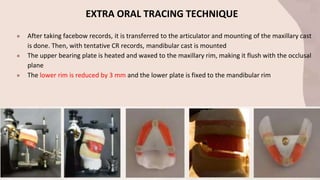 PROGRAMMING OF HANAU WIDE VUE & GOTHIC ARCH TRACING.pptx