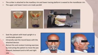 PROGRAMMING OF HANAU WIDE VUE & GOTHIC ARCH TRACING.pptx