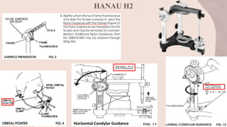 PROGRAMMING OF HANAU WIDE VUE & GOTHIC ARCH TRACING.pptx