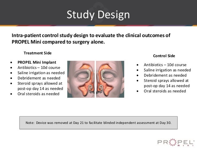 PROGRESS Study: PROPEL Mini Steroid Releasing Implant