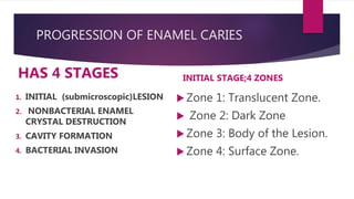 Progression oEnamel caries | PPTX