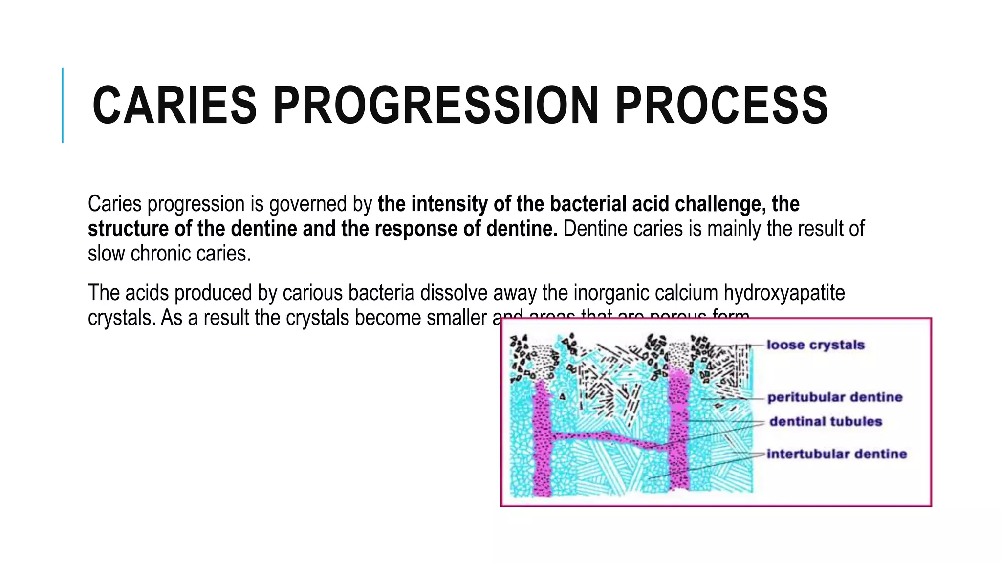 Progression of dental caries in dentine | PPTX
