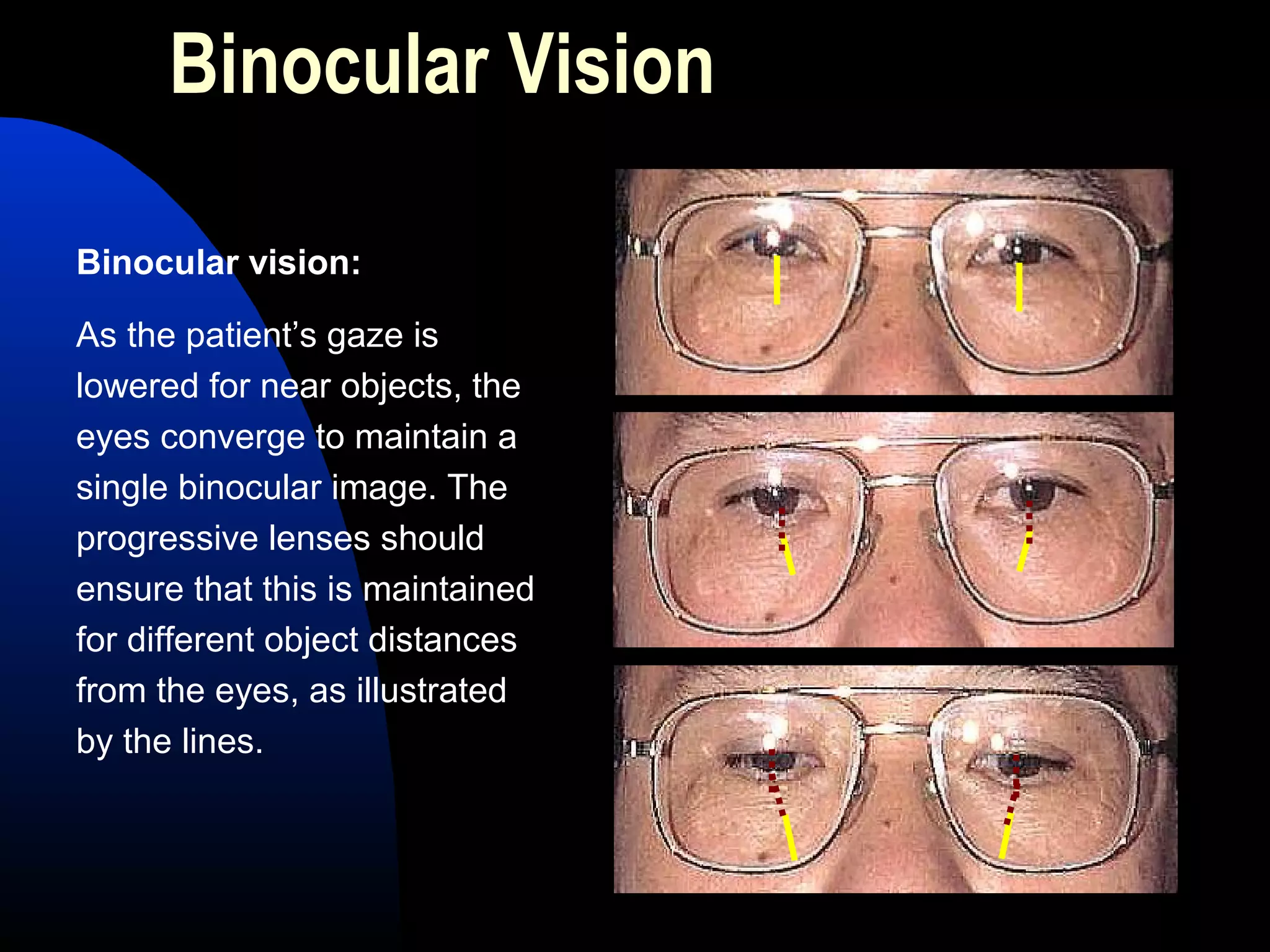 Progressive addition lens | PPT