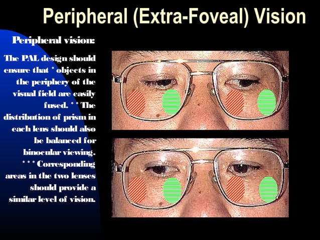 Progressive addition lens | PPT | Eye and Vision Conditions | Diseases ...