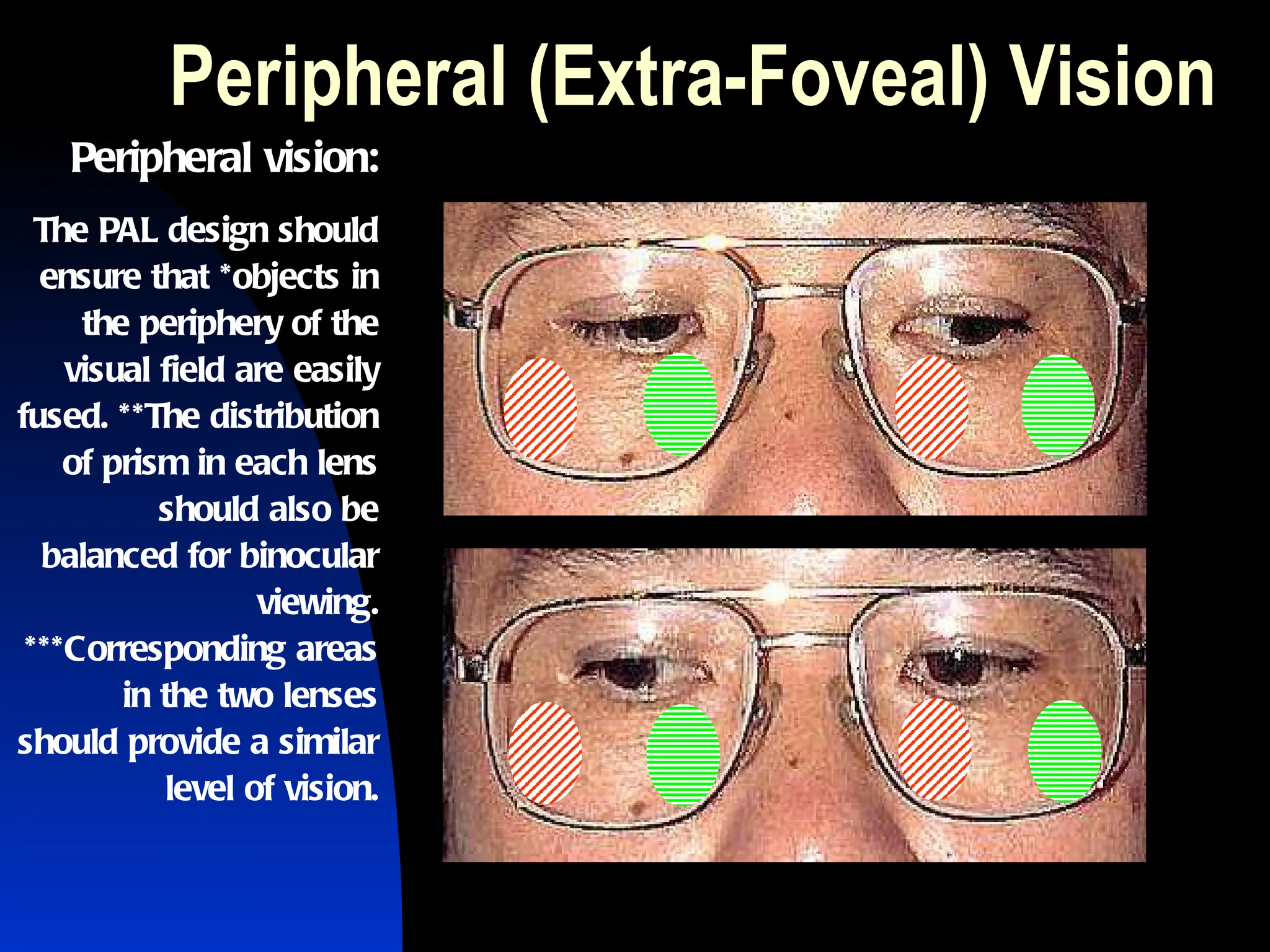 Progressive addition lens1 | PPT