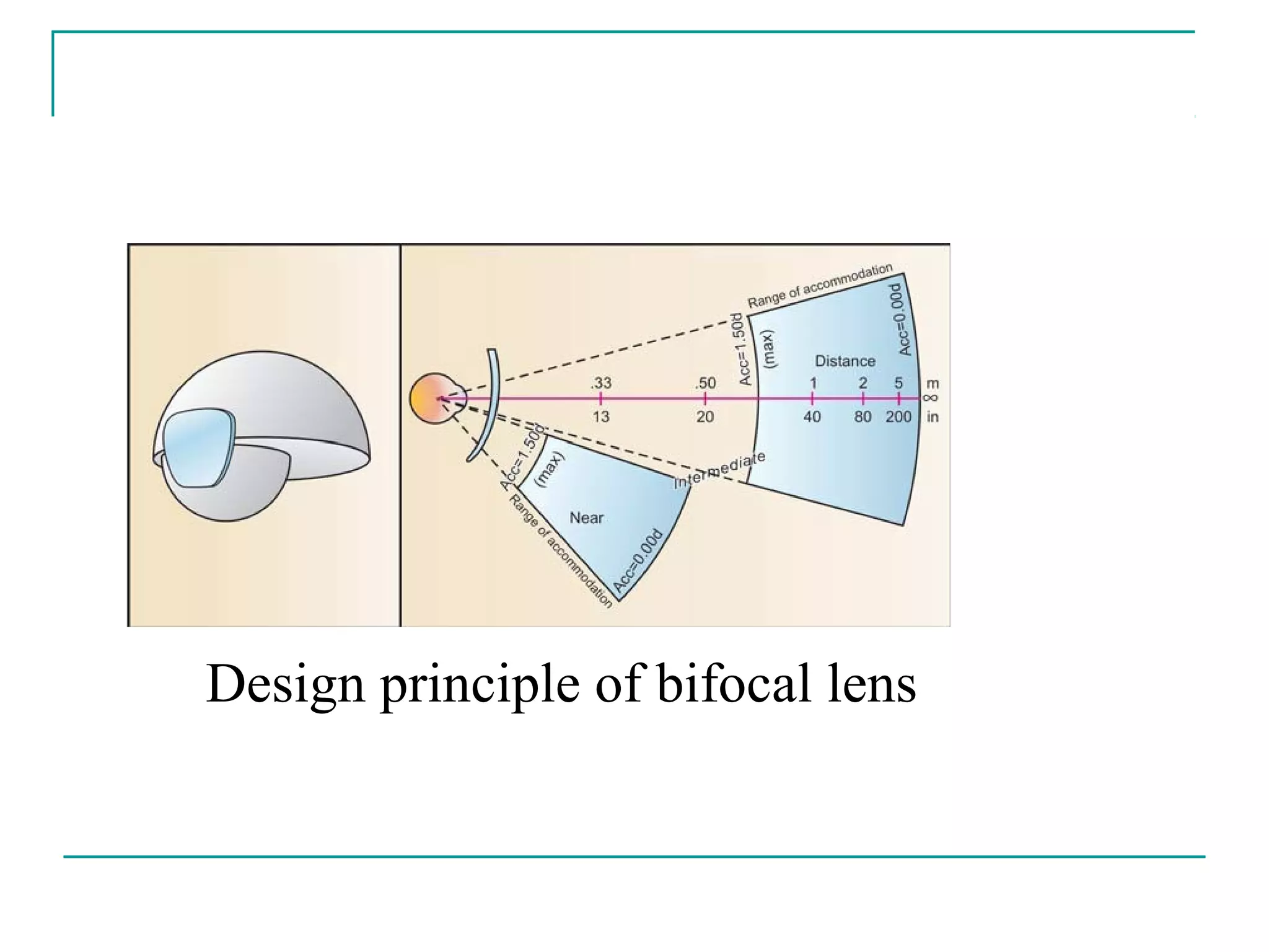 Progressive addition lenses | PPT