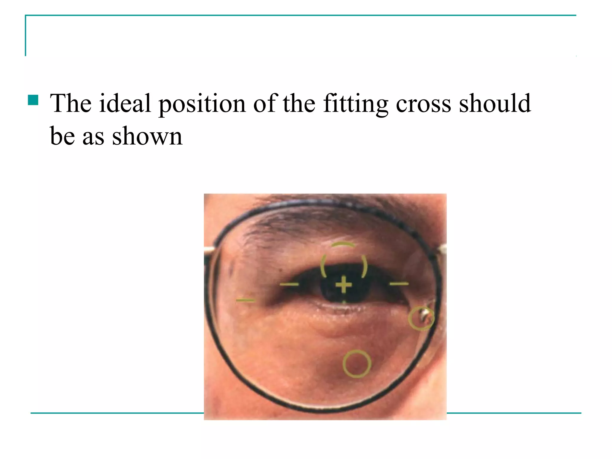 Progressive addition lenses | PPT