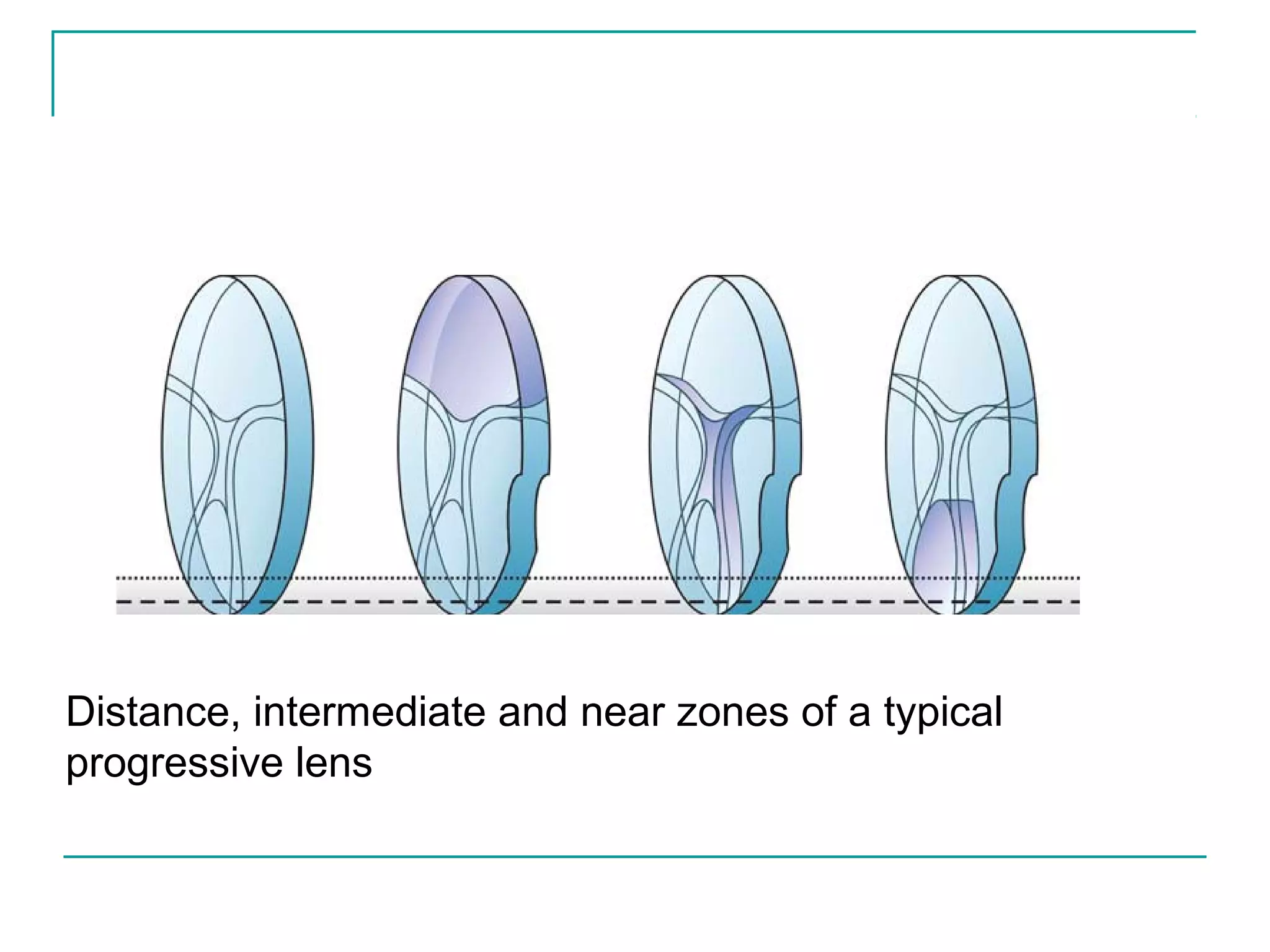 Progressive addition lenses | PPT