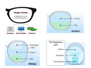 Progressive addition lenses | PPTX