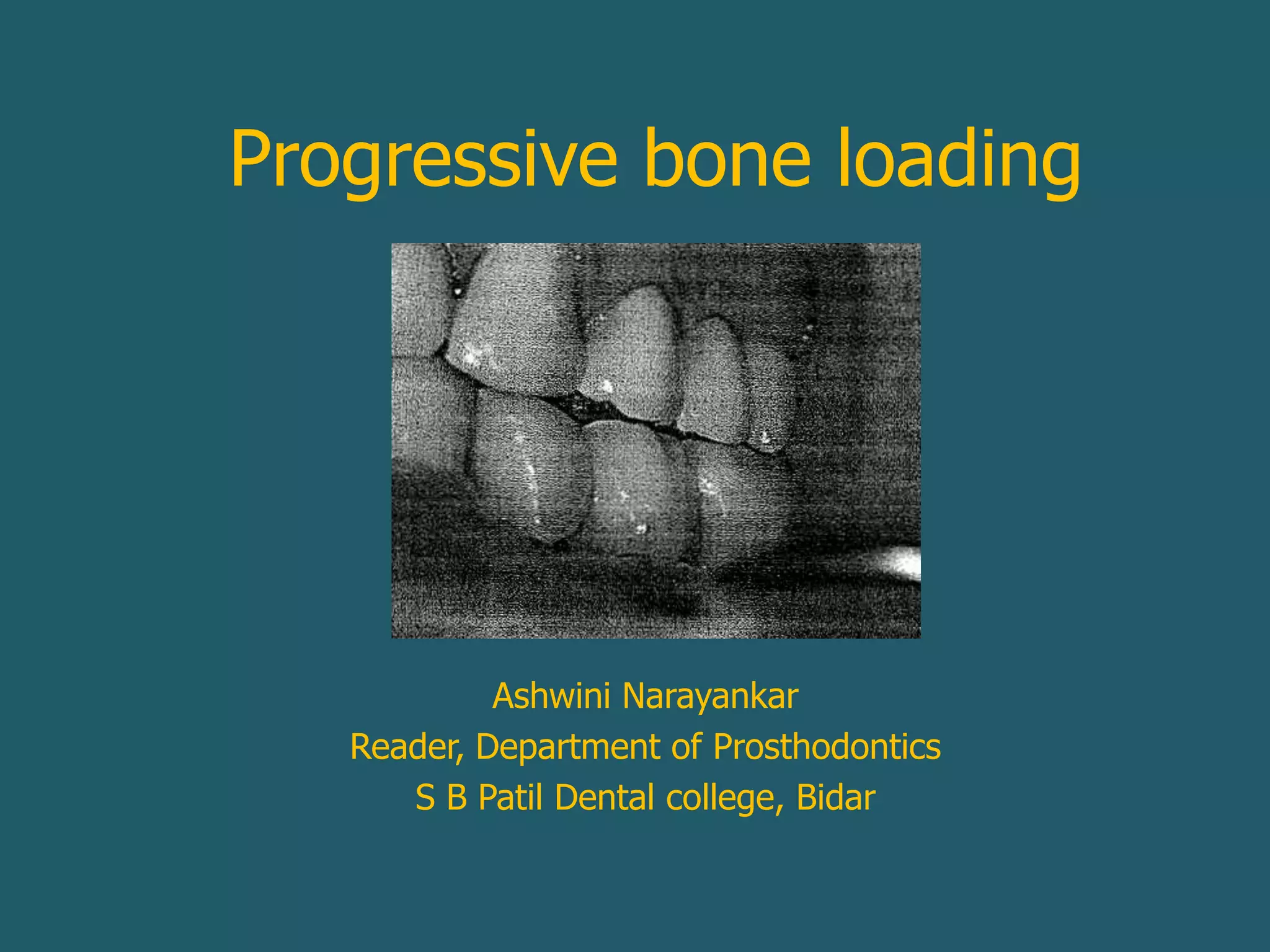 progressive bone loading.pptx