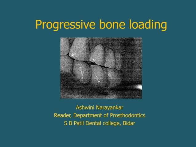 progressive bone loading.pptx