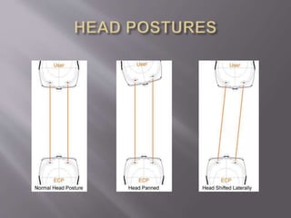 Progressive lens dispensing | PPTX