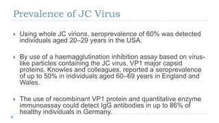 Progressive multifocal leukoencephalopathy | PPTX