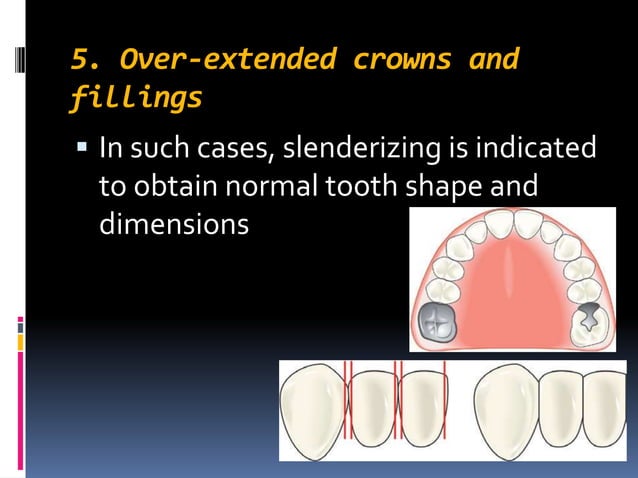Progressive slenderizing technique | PPT