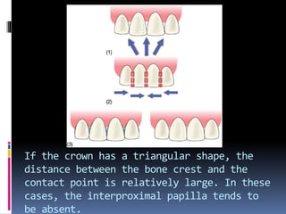 Progressive slenderizing technique | PPT