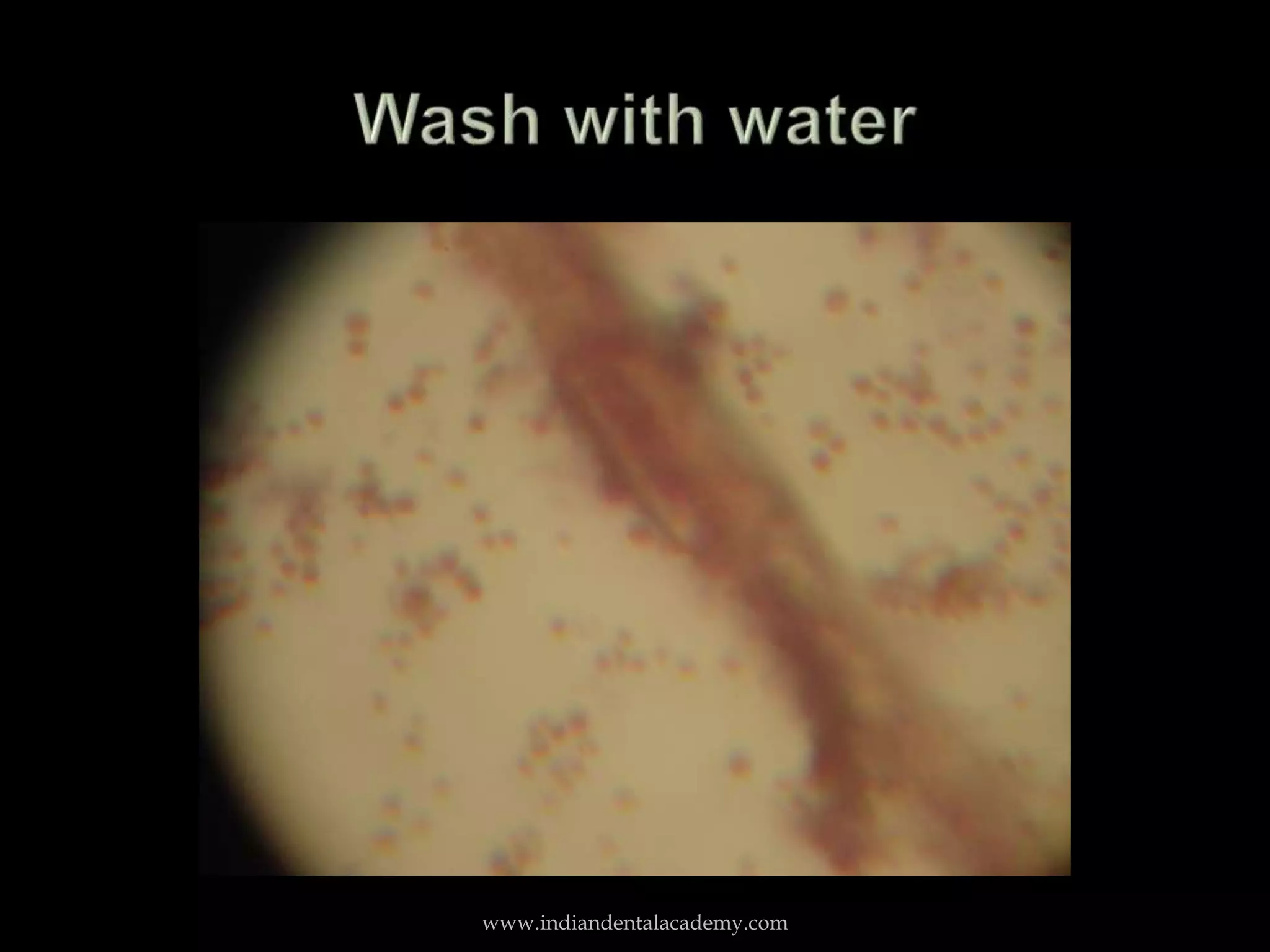 Progressive staining/ oral surgery courses | PPTX