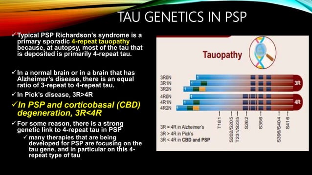 Progressive supranuclear palsy richardson syndrome 060419 | PPTX