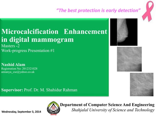 Microcalcification Enhancement in Digital Mammogram | PPT