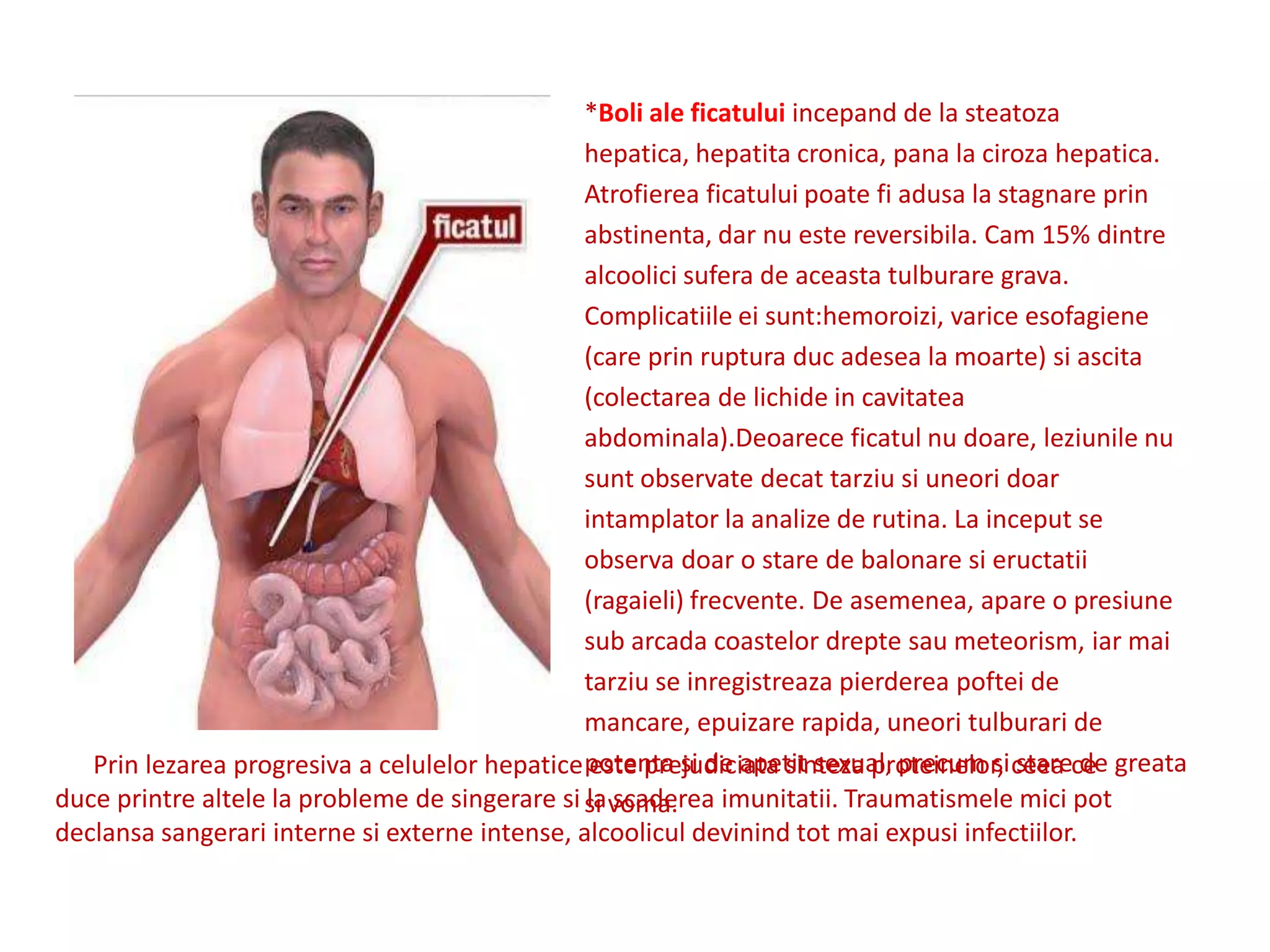 Proiect10 b popescunicolae | PPTX