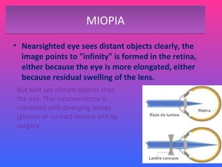 P roiect ochiul dogariu cerasela | PPT | Free Download