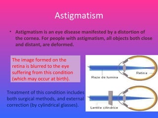 P roiect ochiul dogariu cerasela | PPT