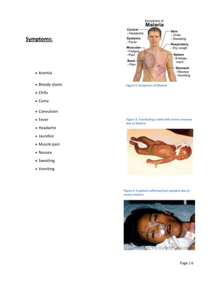 Project Paper on Malaria | DOCX