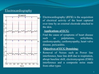 ECG DENOISING USING NN.pp | Digital Audio | Computer Software and Applications