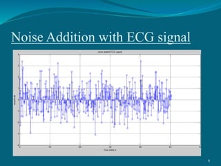 ECG DENOISING USING NN.pp | Digital Audio | Computer Software and Applications