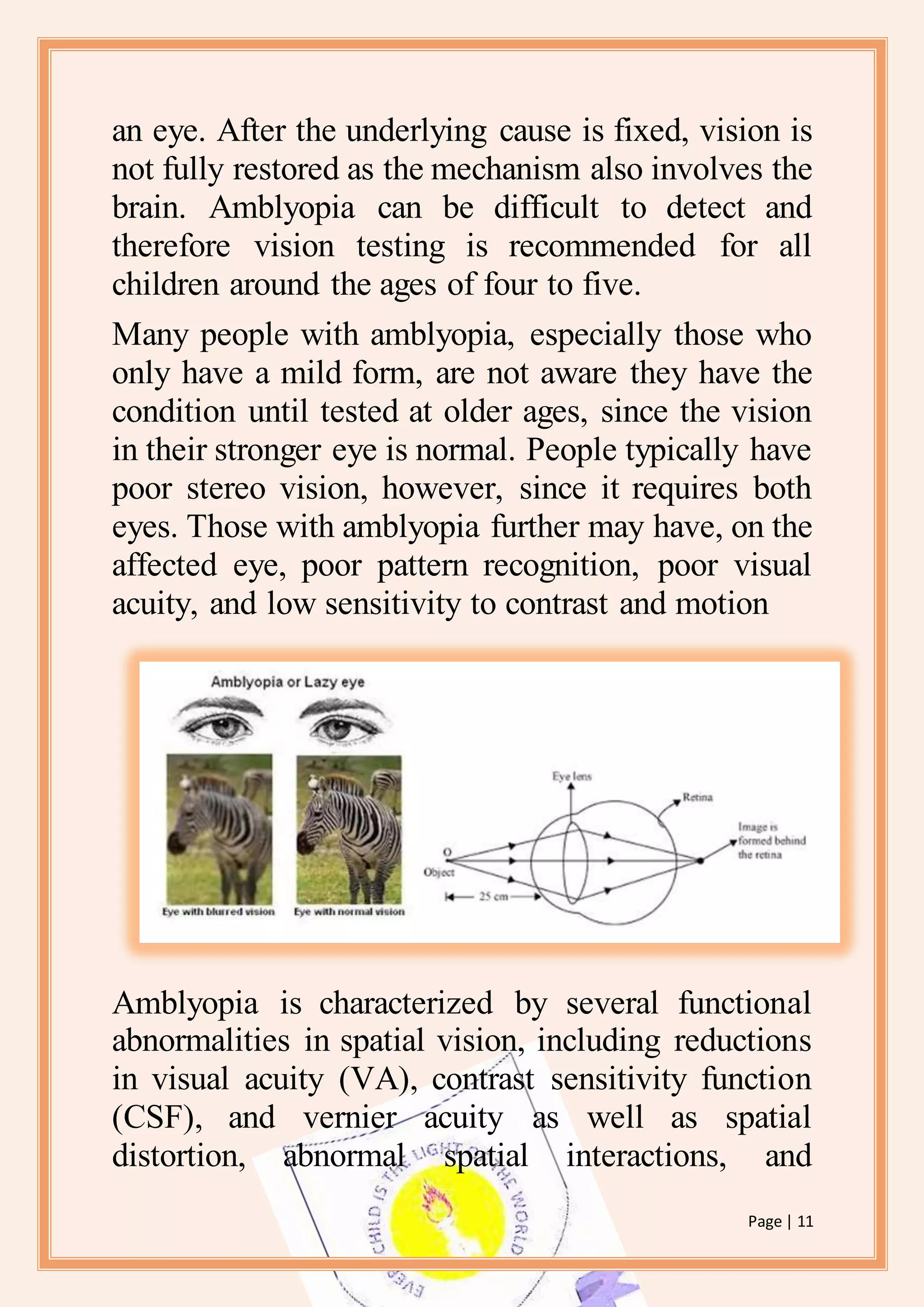 Biology Investigatory Project on Eye Diseases (class 12th) | DOCX