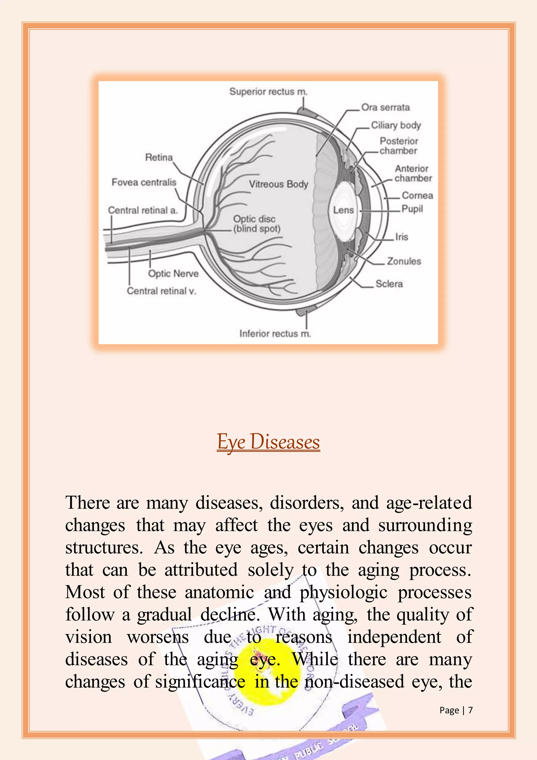 Biology Investigatory Project on Eye Diseases (class 12th) | DOCX
