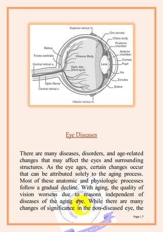 Biology Investigatory Project on Eye Diseases (class 12th) | DOCX