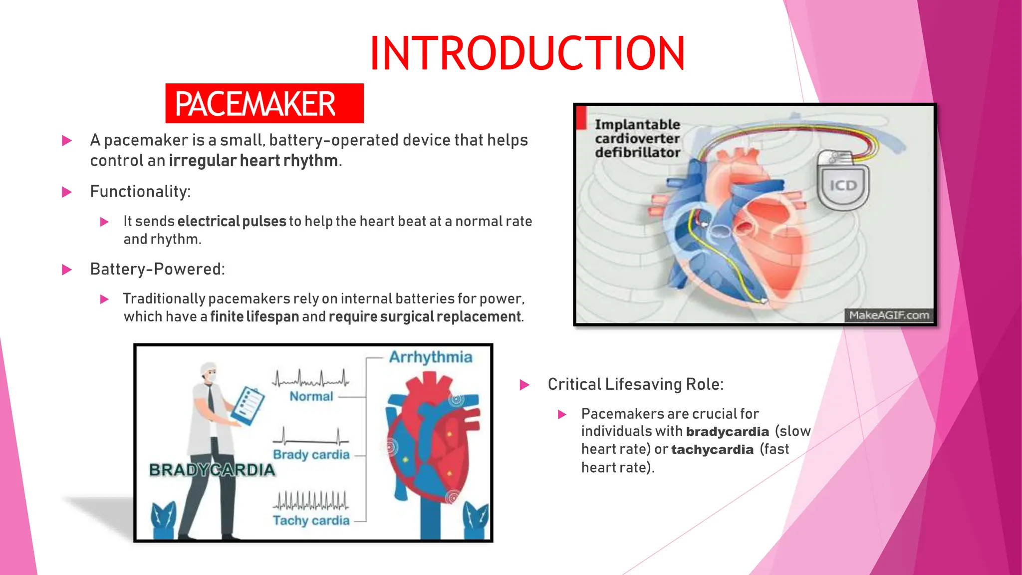 Wireless Charger for implantable pacemakers.pptx