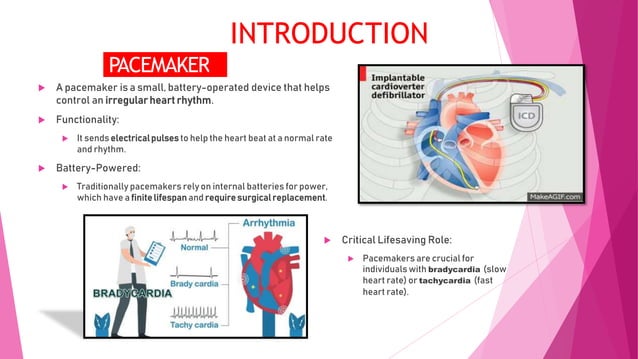 Wireless Charger for implantable pacemakers.pptx