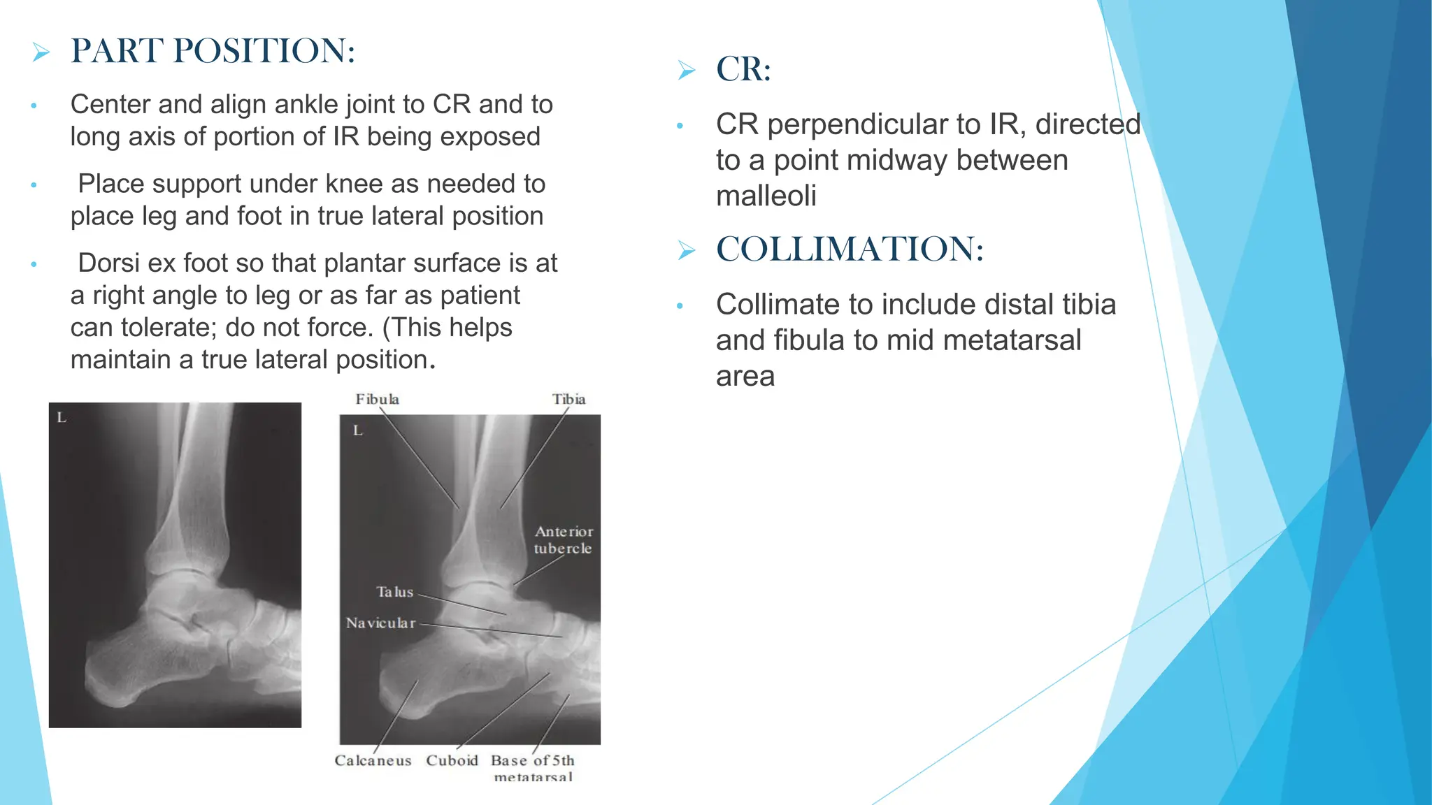 PROJECTION OF ANKLE(KARSANG FENGTE)-1.pdf
