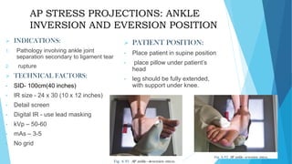 PROJECTION OF ANKLE(KARSANG FENGTE)-1.pdf | Free Download