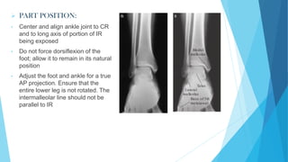 PROJECTION OF ANKLE(KARSANG FENGTE)-1.pdf